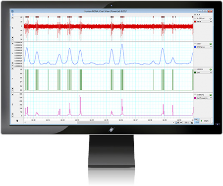 Microneurography Data Analysis | LabChart Demonstration | ADI
